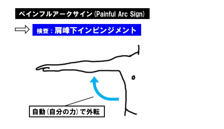 【図付き】肩の整形外科的テスト(8種)/腱板損傷・腱板断裂・肩インピンジメント症候群 — 理学療法士国家試験対策PTES